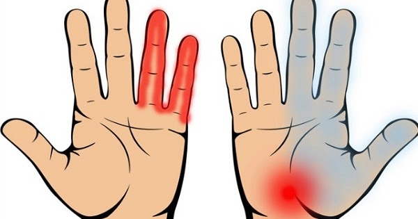 Inilah 7 Petanda Penyakit Yang Kita Boleh Tahu Hanya Daripada Tapak ...