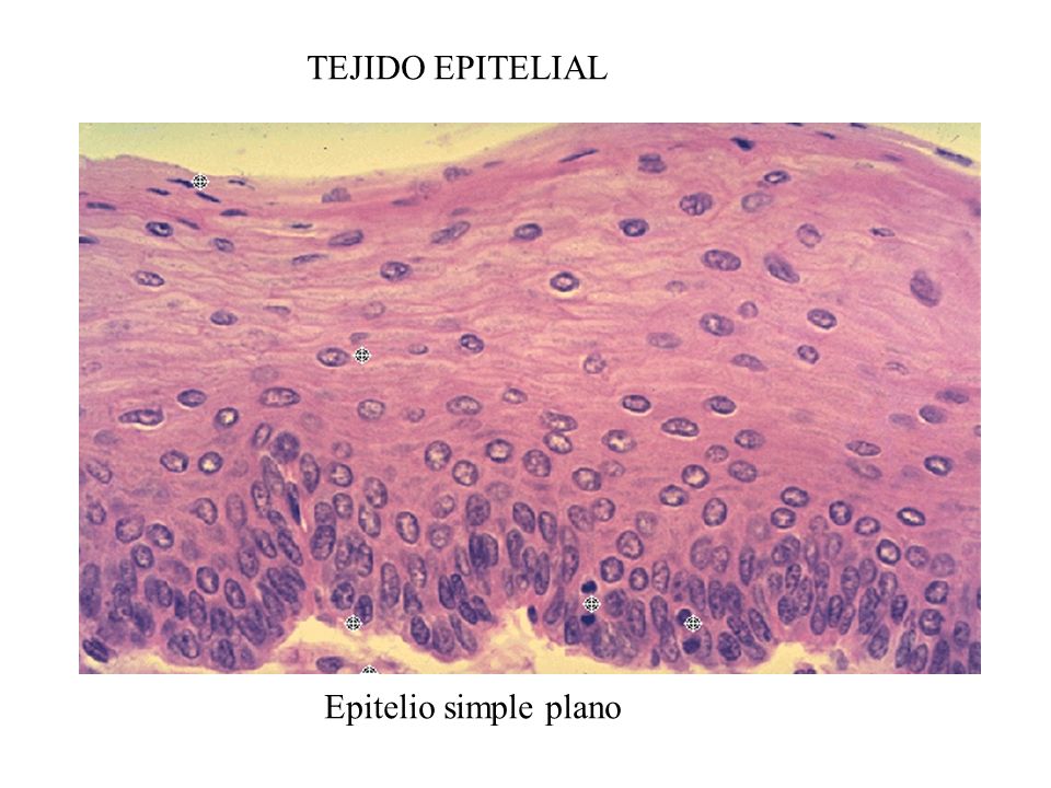 CLASIFICACIÓN DE LOS EPITELIOS