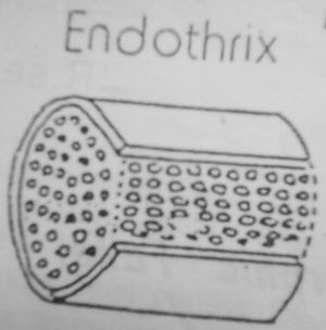 DERMATOPHYTOSIS | All Microbes