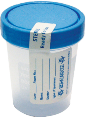 PENGAMBILAN SPECIMEN / SAMPEL URINE | Kampus Kesehatan