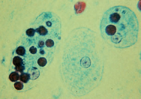 Infection Landscapes: Amoebiasis