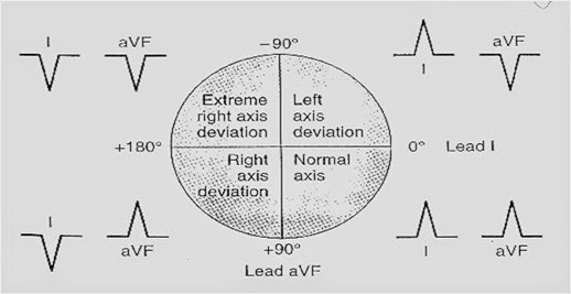 Cara cepat membaca Elektrokardiogram (EKG) | SholehShare