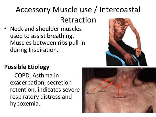Best technique for Diaphragmatic Breathing ~ akufisio.blogspot