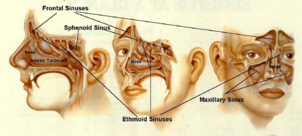 Blog 75: Infos santé-Sinusite
