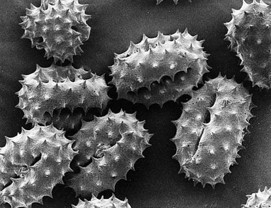 Learning_Bloggirl: Microscopy & Prokaryote