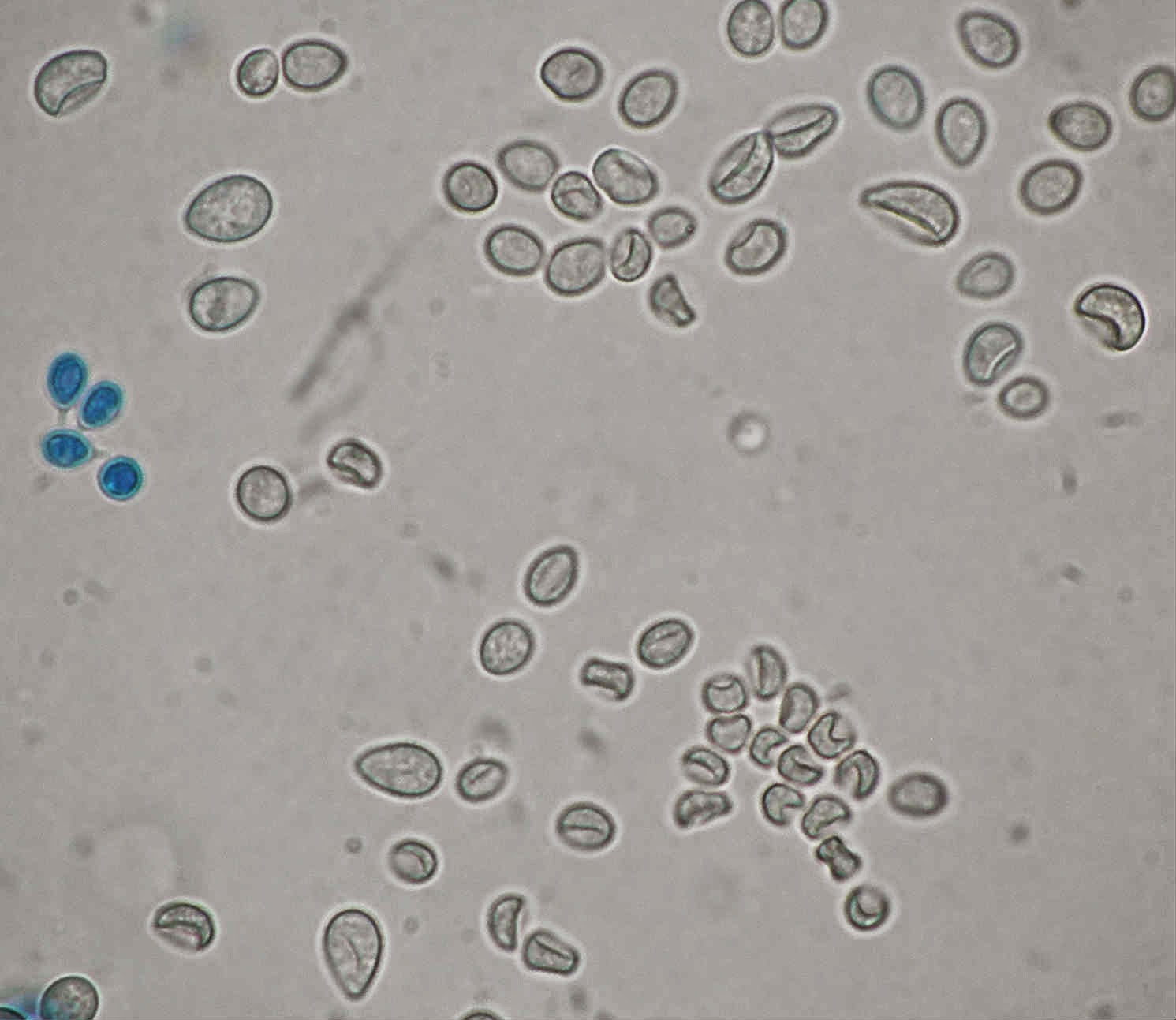 ATLAS MICOLOGIA: CUNNINGHAMELLA BERTHOLLETIAE