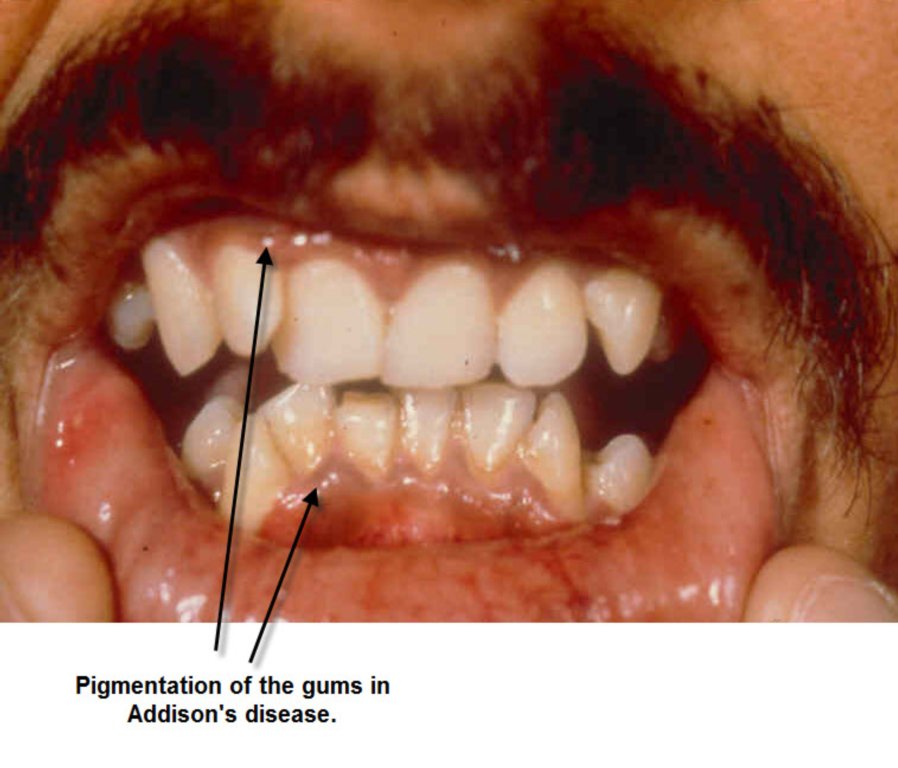 Dermatology For Dentists and Dental Students: Oral Pathology for Doctors