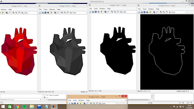 Ahmet Öztürk Mechatronics: Matlab Image Processing: Edge Detection Sample