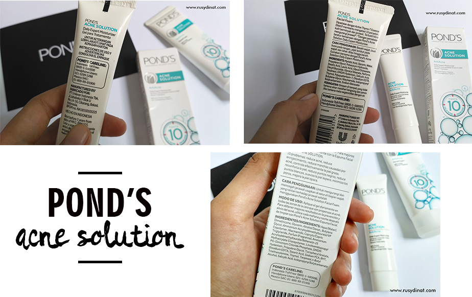 Bundle Of Joy: Review POND’S Acne Solution