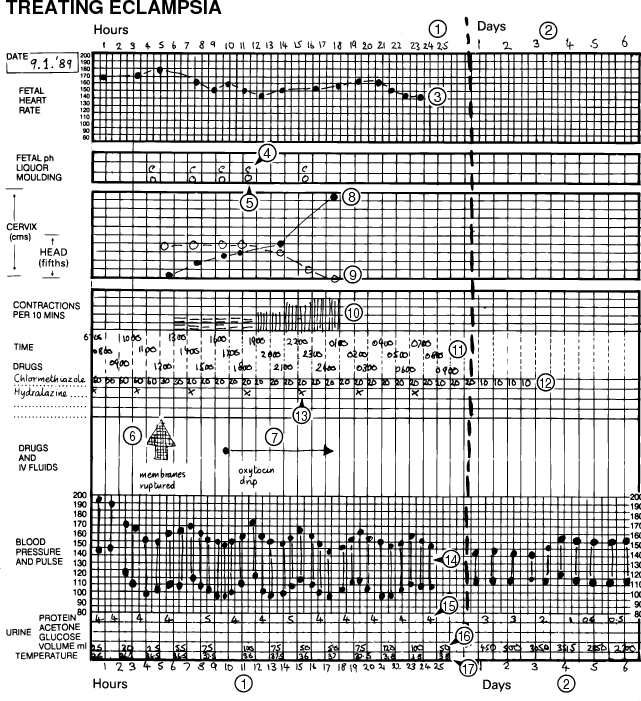 Partograf, Partogram, Gravidogram, Contoh Medical Articles