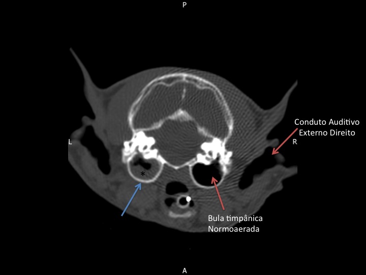 CRVImagem: Otite Média / Interna - Papel dos métodos avançados de ...