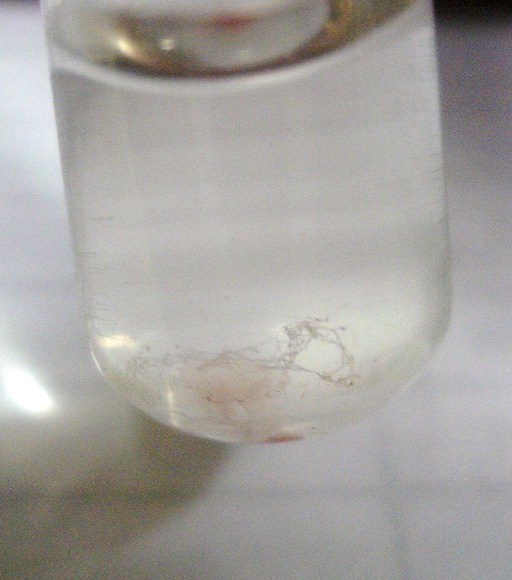 The Learner: Tuberculosis, continuing to ravage. . . Celebrating World ...