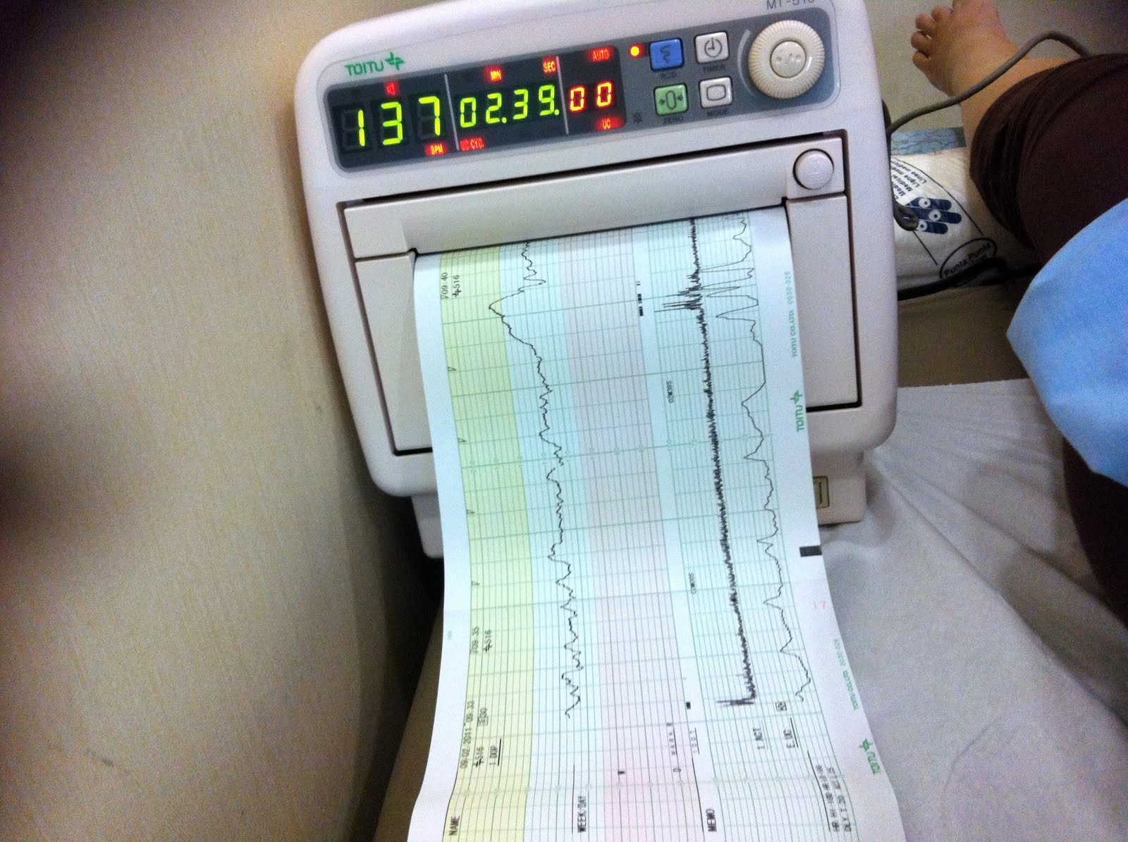 King Wentong + Queen Maydeline = Prince Jaden & Prince Javier: CTG Scan ...