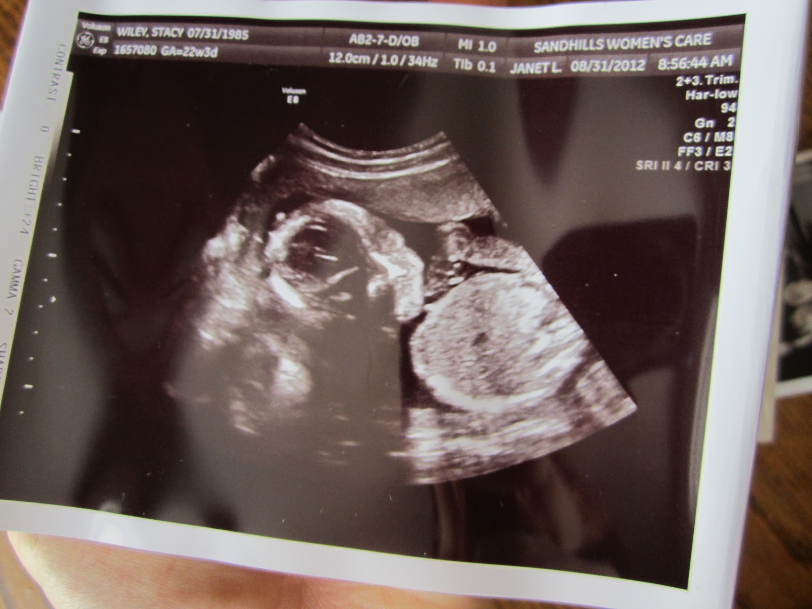 The Wiley Family: 21 Week Ultrasound