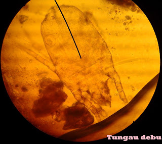 KLIMAKS: Caplak & Tungau