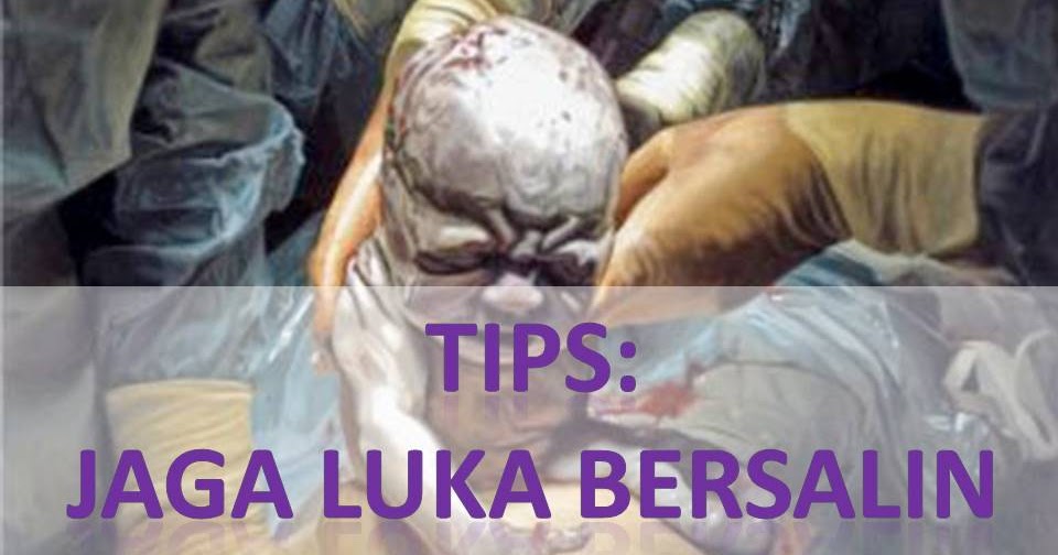3D health beauty supplement: TIPS MENJAGA LUKA BERSALIN AGAR CEPAT ...