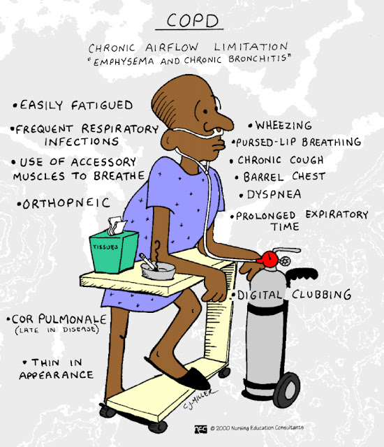 ALL FOR NURSING: MS: COPD Chronic Obstructive Pulmonary Diseases