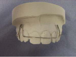 Dentistry lectures for MFDS/MJDF/NBDE/ORE: A Note on Active Components ...