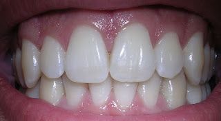 Dentosphere : World of Dentistry: MCQs on Oral Histology - Enamel