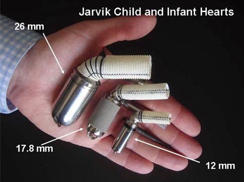 Live The Blog!: Invention Of Artificial Heart