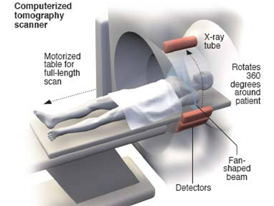 ektalks: Medical Imaging - Computer Tomography (CT) Effect of Ionising ...