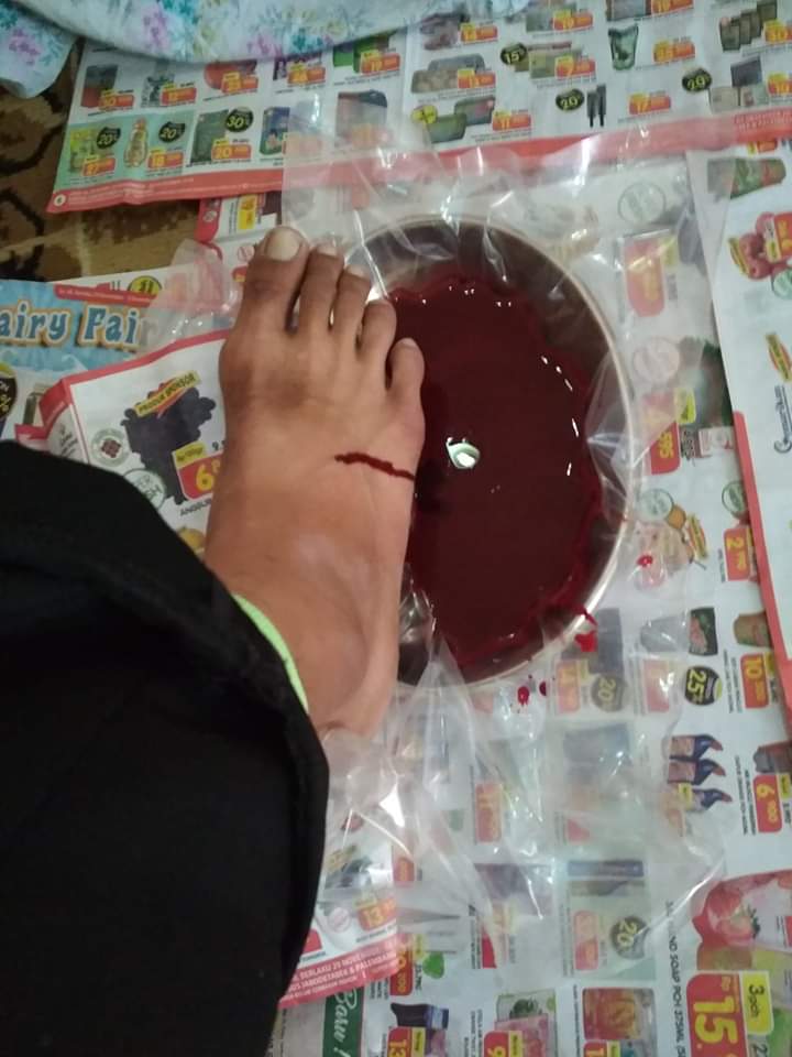 Fashdu Menurut Kedokteran - Perumperindo.co.id