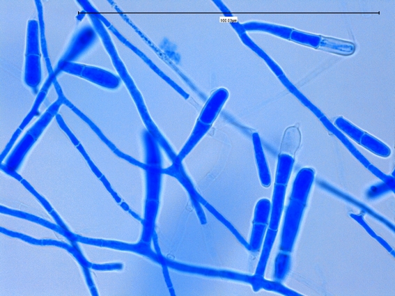 Fun With Microbiology (What's Buggin' You?): Epidermophyton floccosum