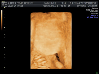 Growing Baby Shelton: Growth Ultrasound and ECHO