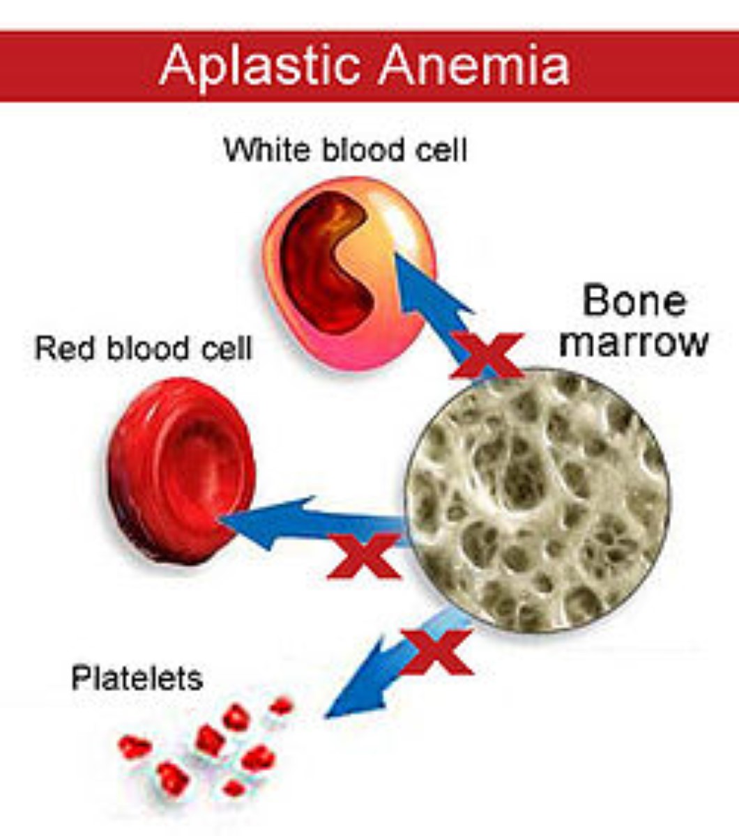 PRODUK TERBAIK UNTUK MASALAH ANEMIA - CUTE AND BEAUTY