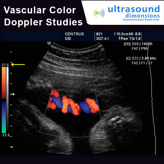 Vascular Color Doppler Studies