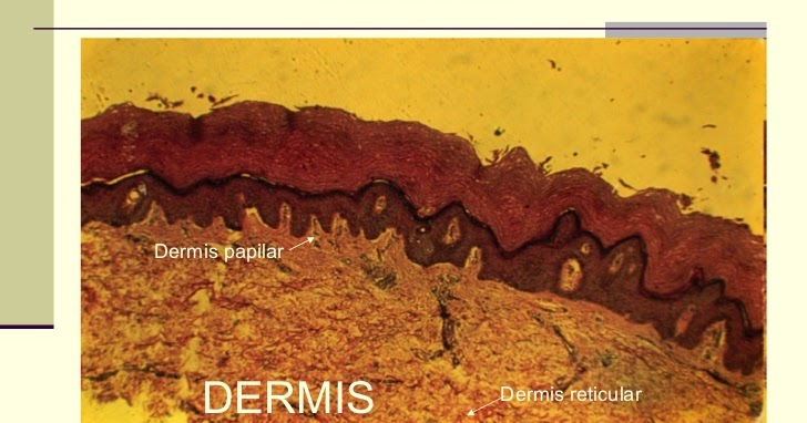 PIEL: DERMIS