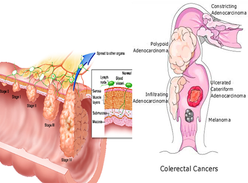 Often Eat Fried Potato Hazardous to Your Health - HEALTHY SNACKS BRAND