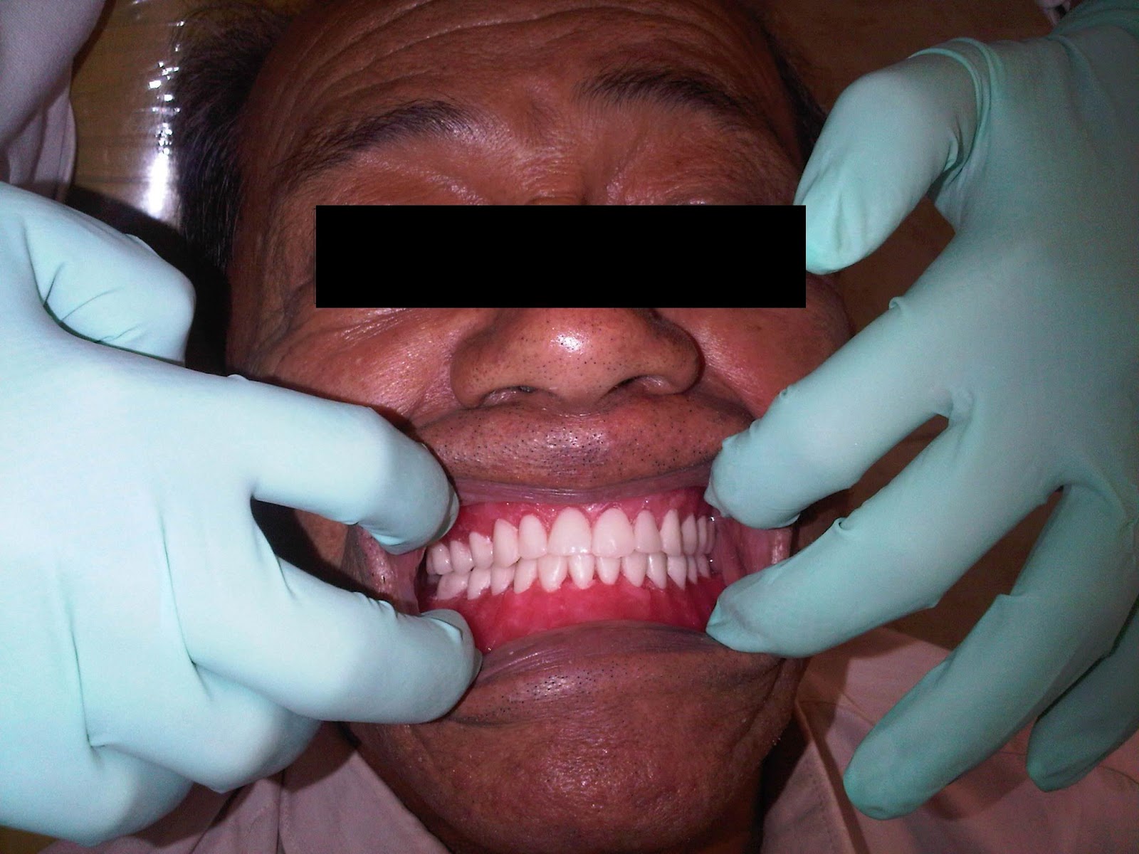 Casos Clínicos Odontológicos: Caso Clínico # 2