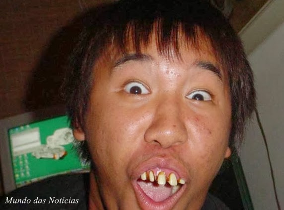 Os 10 homens mais feios do mundo: Confira! | Notícias do Dia