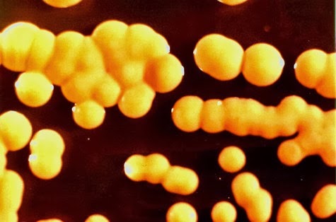 LAS BACTERIAS : IMÁGENES