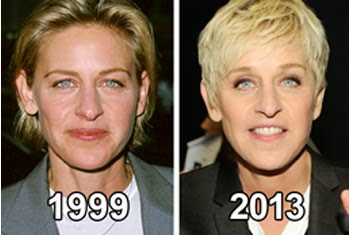 Ellen DeGeneres's Anti-Aging Trick Finally Exposed! ~ PillsExposed!
