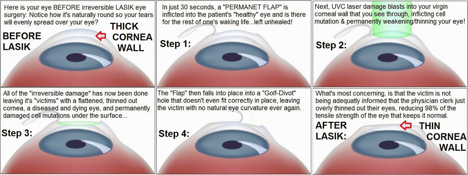 LASIK PUBLIC HEALTH ADVISORIES ISSUED: : LASIKADVISORY.COM WAS BORN ...