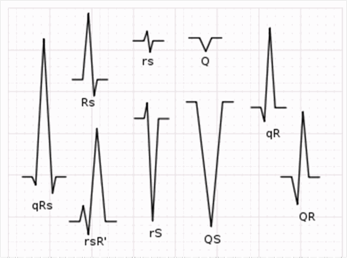 EKG Itu mudah loh ! ~ BelajarEKG