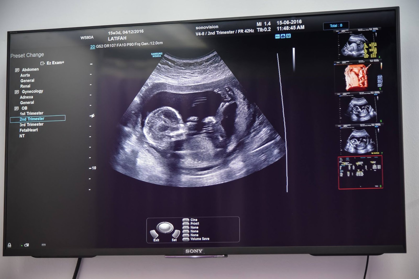 5D 6D SCAN SONOVISION: 5D 6D SCAN SONOVISION KELANA JAYA