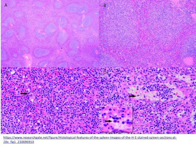 Diferencias histológicas entre las células precursoras de la sangre ...