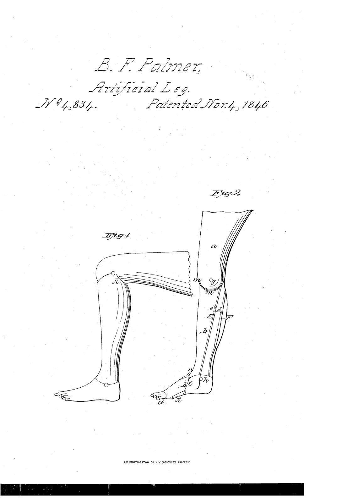 The Artificial Leg, 1846, by Benjamin Franklin Palmer ~ Civil War Rx