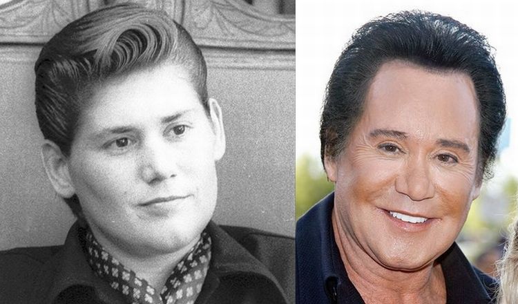 Wayne Newton Plastic Surgery