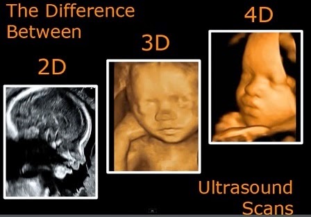 Pemeriksaan USG 2D, 3D, 4D Untuk Kehamilan ~ Maintain Your Health