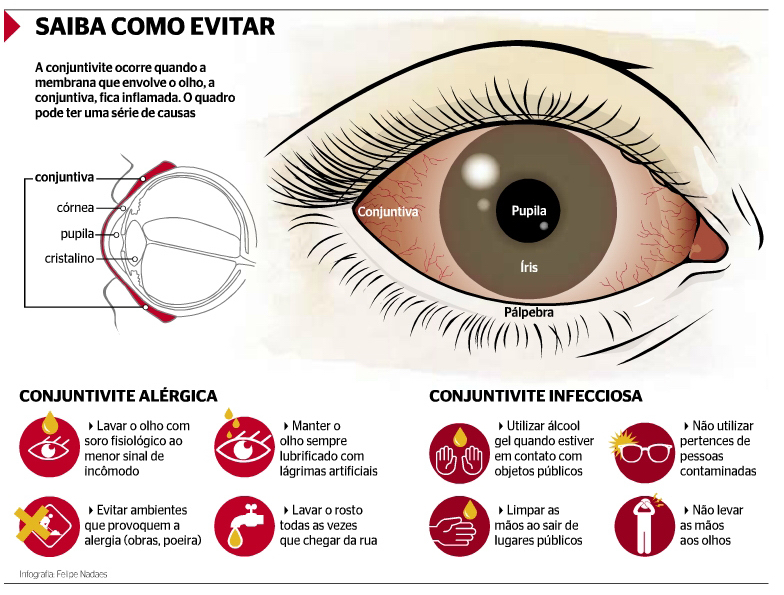 InformeCapital: 450 casos de conjuntivite são registrados no 1 ...
