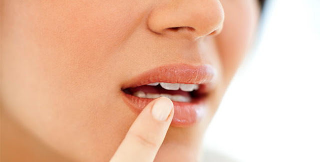 6 Petua Berkesan Hilangkan Ulser Dalam Mulut