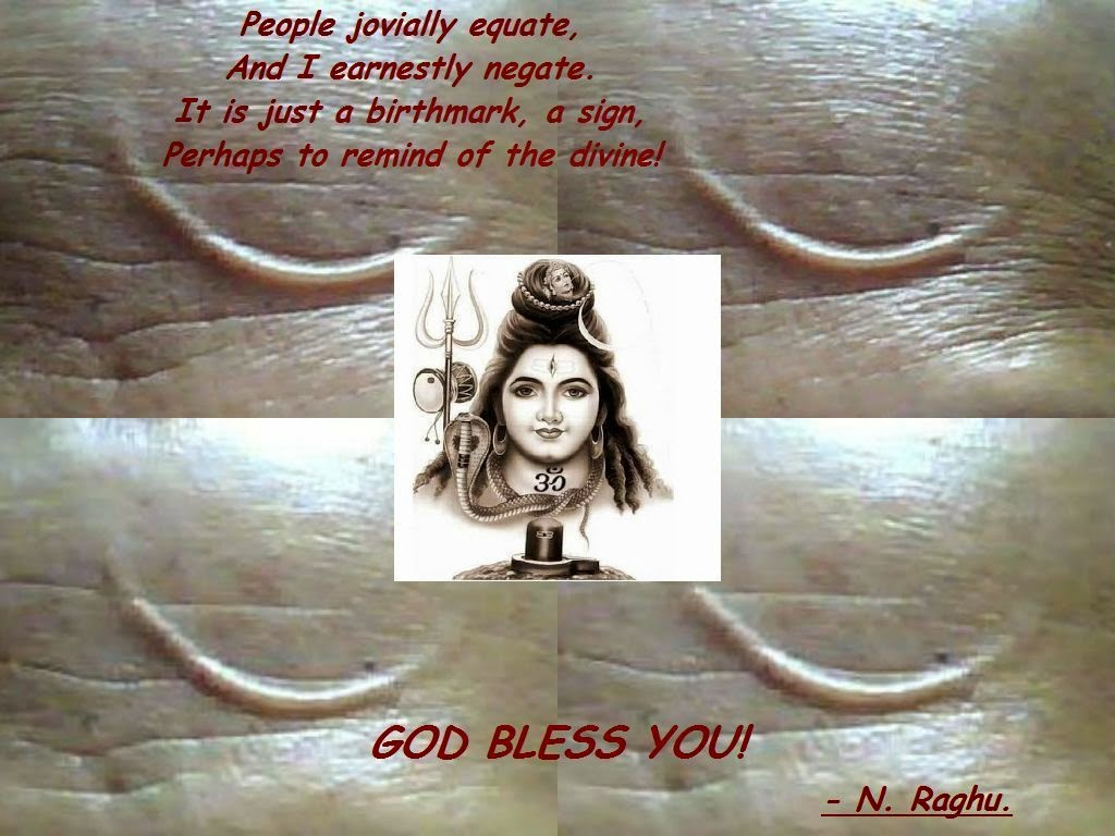 Raghu's column!: About an intriguing birthmark.