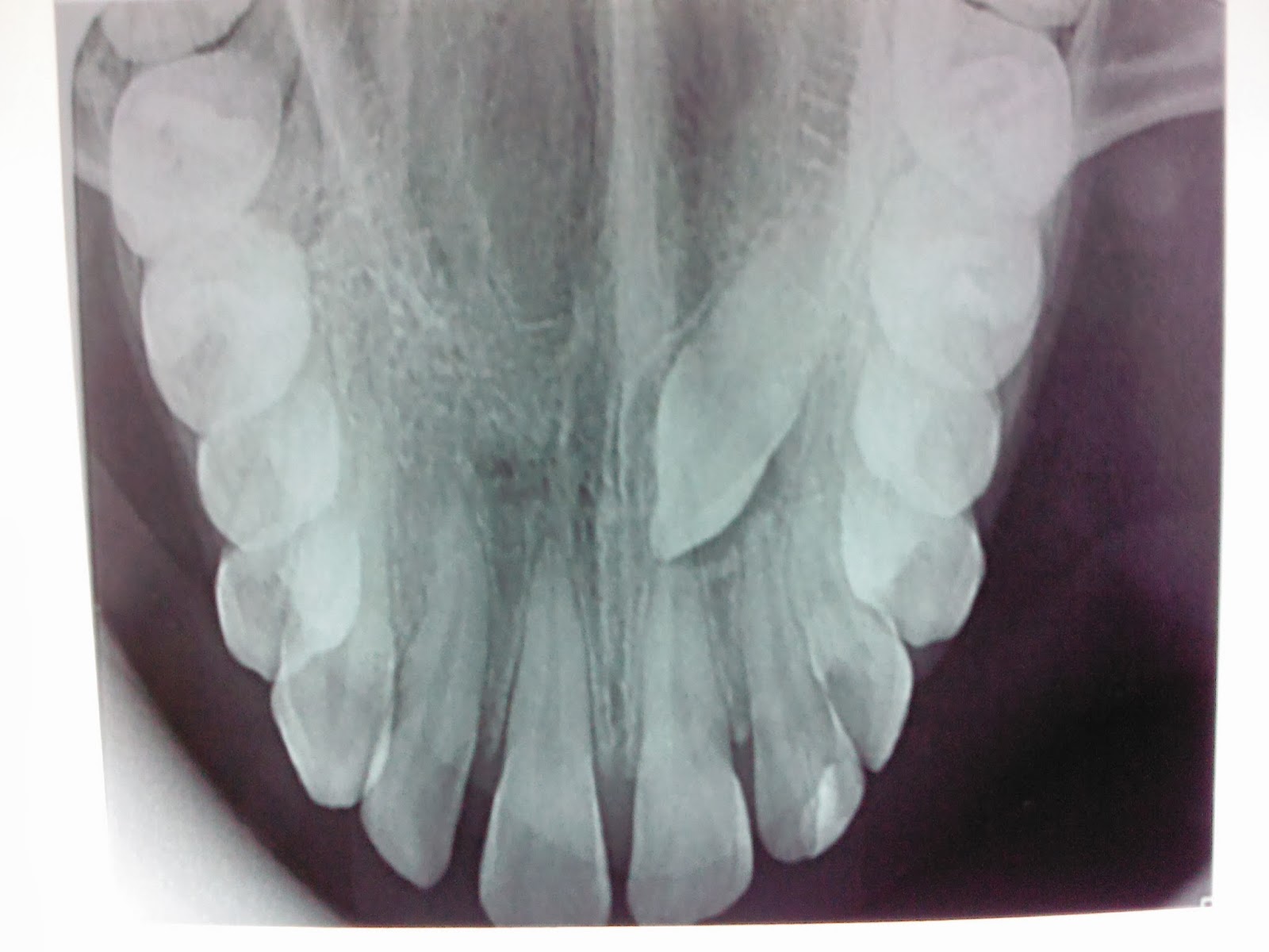 Cirurgia e Traumatologia Bucomaxilofacial
