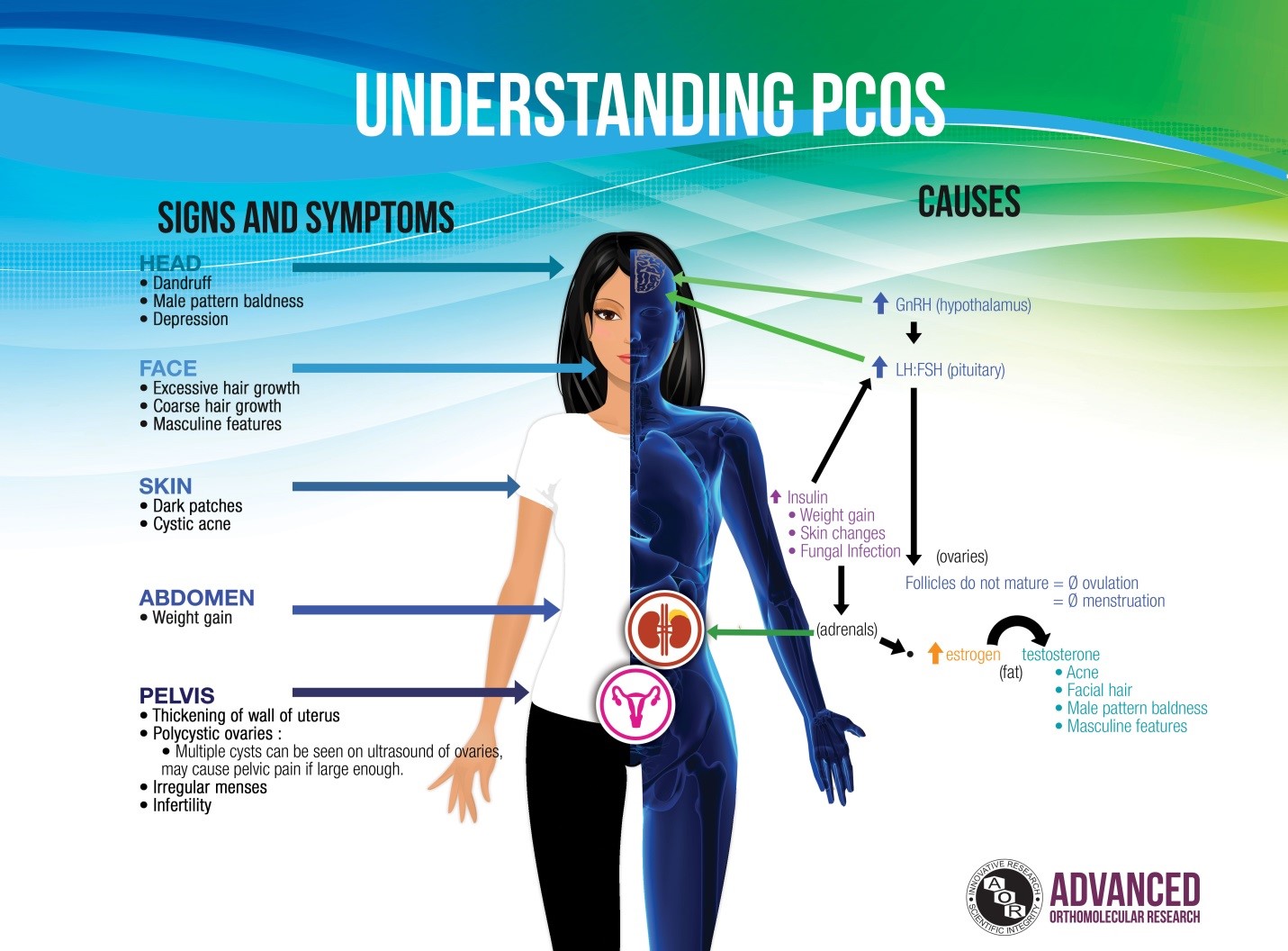Beberapa Langkah Diet PCOs Lengkap Step By Step | PCOs