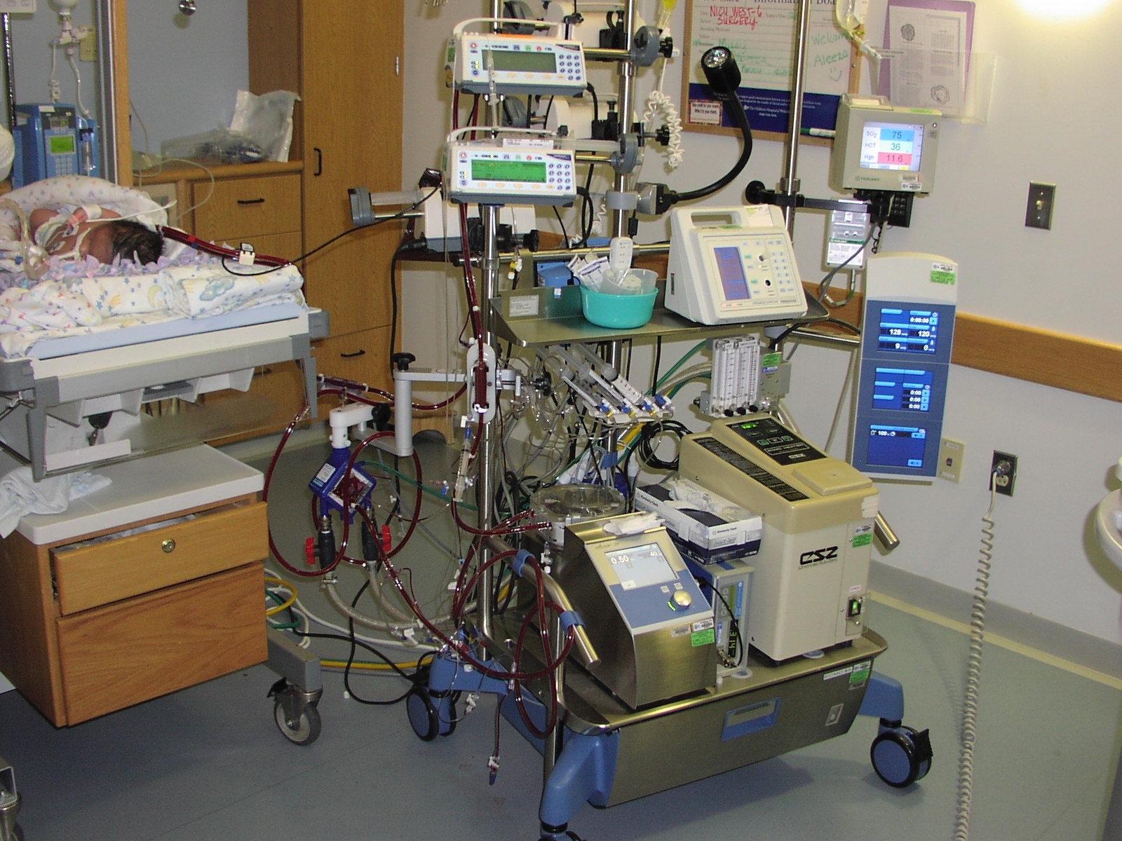 CHOP ECMO News