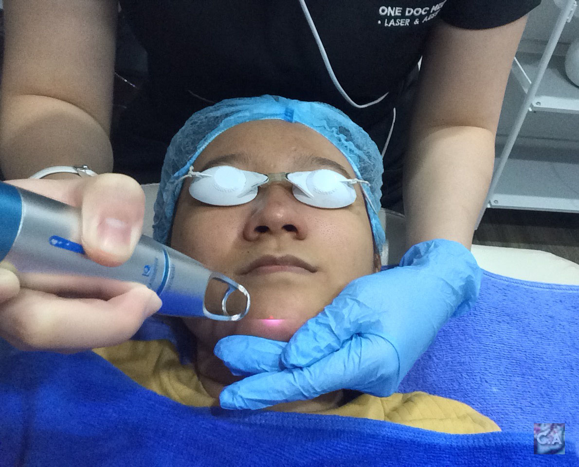 One Doc Medical Laser & Aesthetics, Publika: Signature 4-step Medical ...